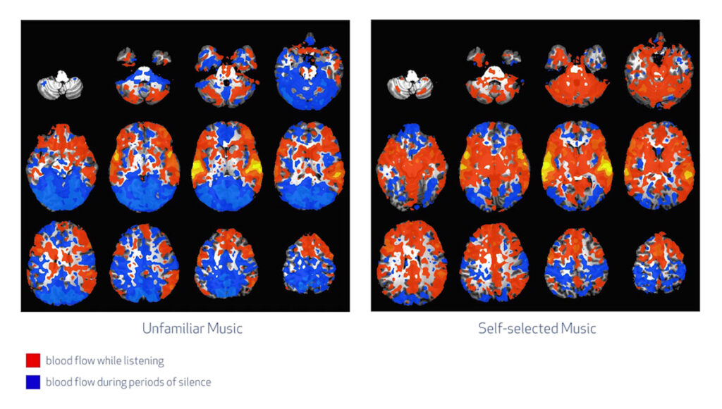 15 Surprising Ways Music Benefits our Health - BrainTap